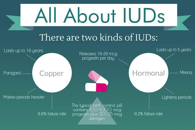 theNotice - What it's like to get an IUD (and why you need one): A ...